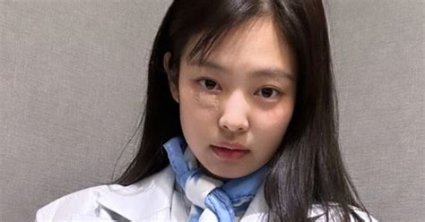 제니 얼굴 눈밑 부상 당당히 공개한 이유
