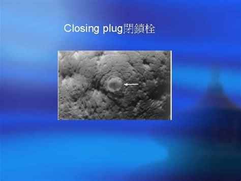 Cleavage And Implantation Day 1 Day 14