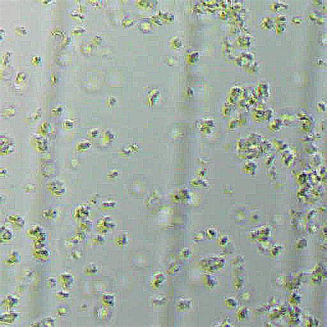 Blood Cell Detection V2 Object Detection Dataset And Pre Trained Model