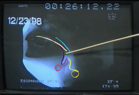 Mbss Landmarks Set 1 Diagram Quizlet