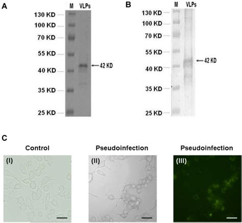 Purification Of Jcv Virus Like Particles Vlps Recombinant Jcv Vlps