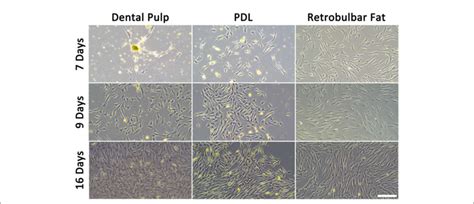 solated MSCs after diierent time points The scale bar represents sss µm Download Scientific