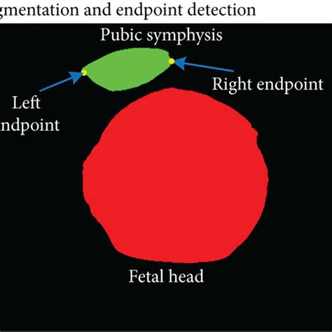 Segmentation And Endpoint Detection Download Scientific Diagram