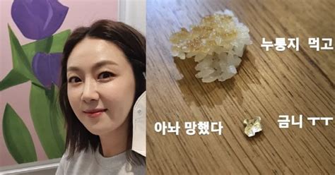 박준형♥ 김지혜 이게 웬 날벼락 충격적인 치아 상태 술이 원수