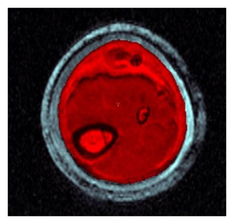 Semiautomatic Segmentation Of The Surface Area Of Test Specimen