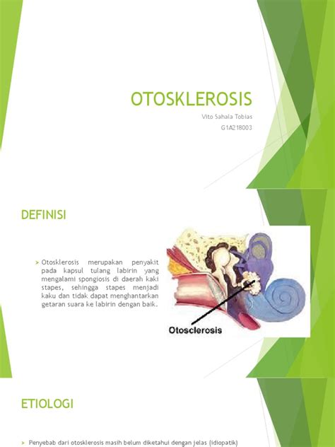 Otosklerosis Pdf