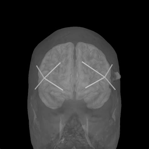 Importing Data From Fnirs Devices — Mne 1101 Documentation