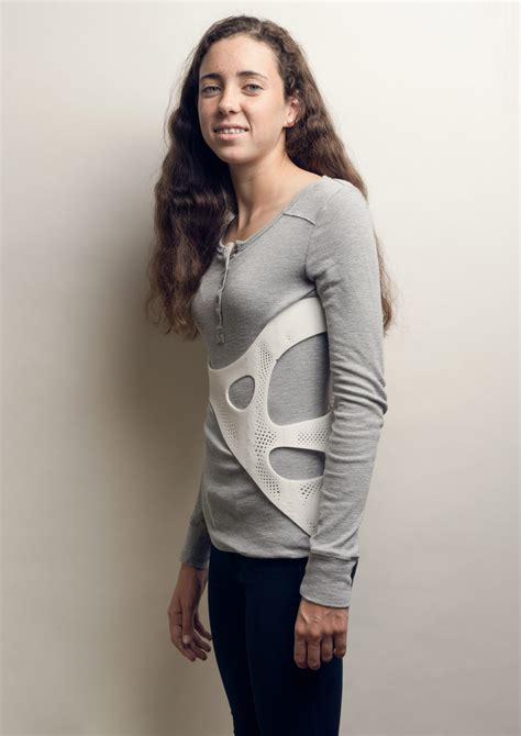 D Printed Back Brace Offers Fashionable Solution For Scoliosis Sufferers