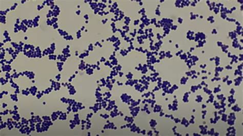 Streptococcus Salivarius Gram Stain