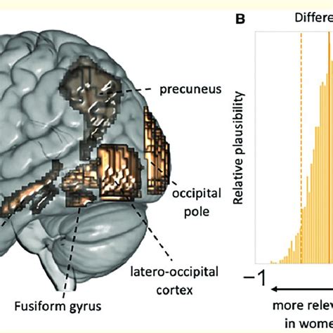 Sex Specific Effects Relating To Left Hemispheric Posterior Circulation