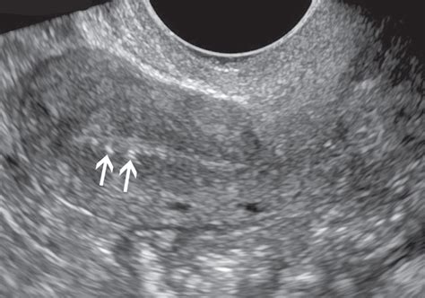 The Uterus Clinical Tree