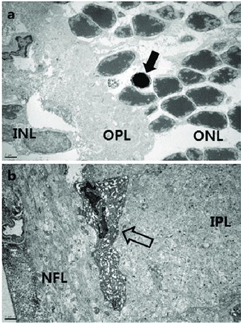Electron Micrographs Taken From 8 Week Glaucoma Retina In A The Download Scientific Diagram