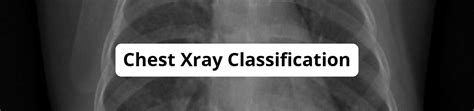 Keremberke Chest Xray Classification Atyun Com 官网 人工智能教程资讯全方位服务平台