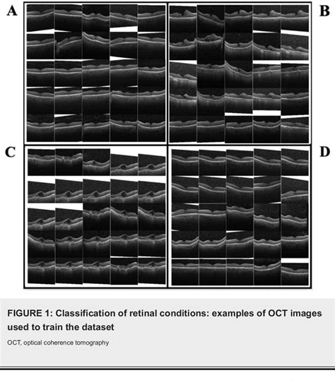 Figure 1 From Evaluation Of Convolutional Neural Networks Cnns In Identifying Retinal
