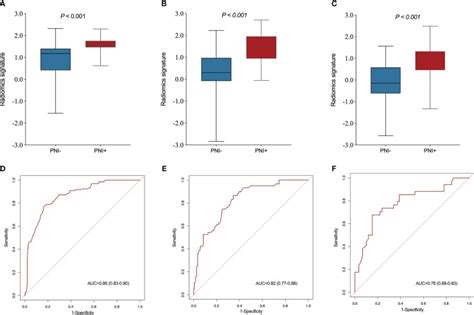The Value Of Machine Learning Based Radiomics Model In Preoperative Detection Of Perineural