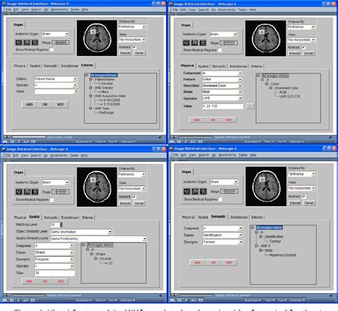 Figure 1 From Image Data Model For An Efficient Multi Criteria Query A Case In Medical