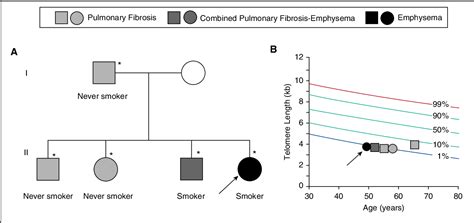 Figure 1 From Telomerase And The Genetics Of Emphysema Susceptibility