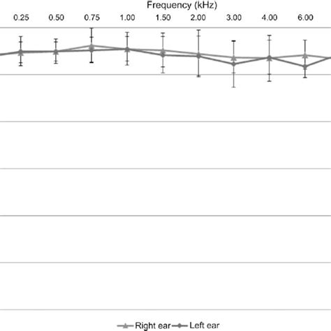 Mean Hearing Threshold Levels ± Standard Deviations For Subjects With