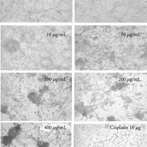 Morphological Representation Of Hepg2 Cells Following The Exposure Of Download Scientific