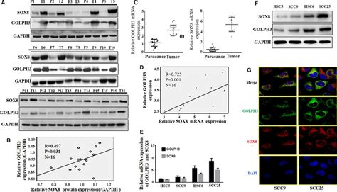 Sox8 Shows Positive Correlation With Golph3 And These Two Are Highly Download Scientific