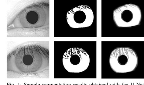 figure 1 from end to end iris segmentation using u net semantic scholar