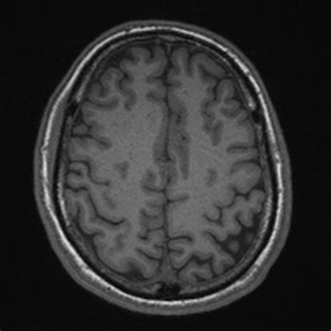 Empirical Performance Of Simple And Structured Sparsity Recovery On Download Scientific Diagram