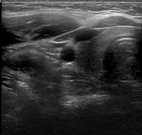 Depth Flashcards Quizlet