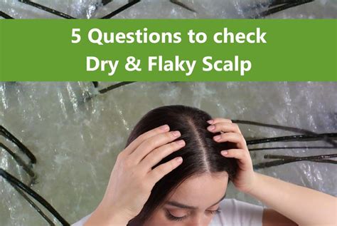 5 Quick Questions To Check For Dry And Flaky Scalp Aromase