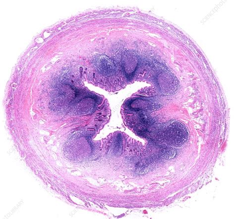 Vermiform Appendix Histology