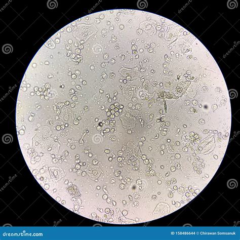 Bacteria In Urine Under Microscope