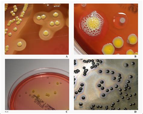 Staphylococcus Aureus Catalase Test