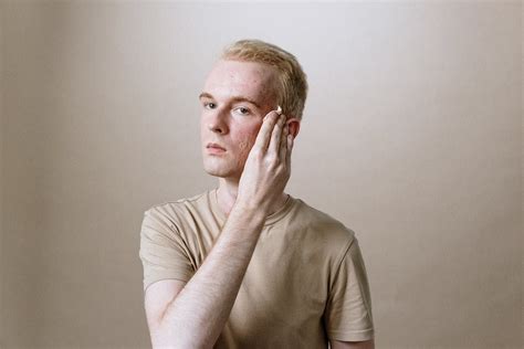 Common Causes And Treatments Of Maculopapular Rash