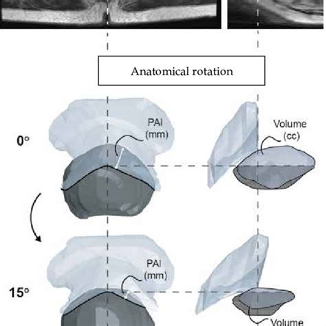 Pipeline For The Evaluation Of The Prostate Datasets A Segmentation Download Scientific