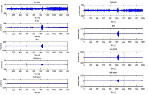 The EEG Signal In Different Frequency Bands From A Patient Suffering Download Scientific