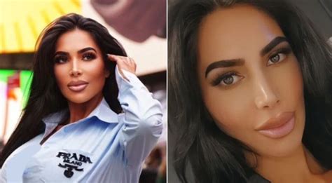 مرگ بدل ایرانی آمریکایی کیم کارداشیان پس از جراحی زیبایی