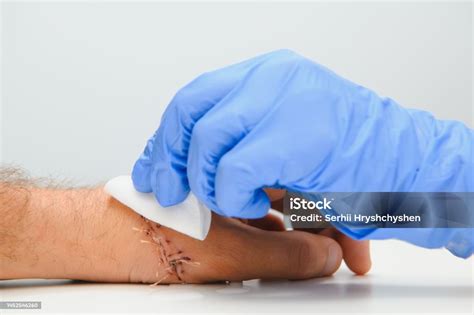 면봉과 드레싱 세트로 상처를 청소하는 간호사 상처 치료 과정 상처에 대한 스톡 사진 및 기타 이미지 상처 수술 부상 Istock