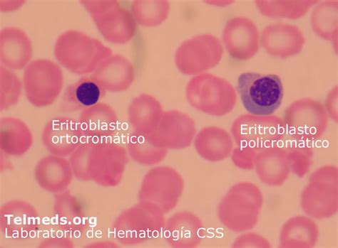 Hematología Eritropoyesis
