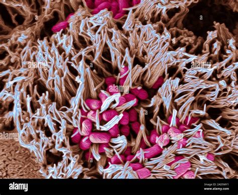 Ehec Bacteria On Small Intestine Tissue Coloured Scanning Electron Micrograph Sem Of Human