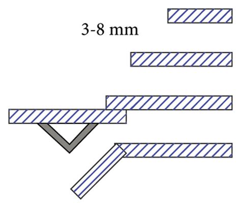 Schematic Diagram Of The Positional Relationship Between The Comb Plate
