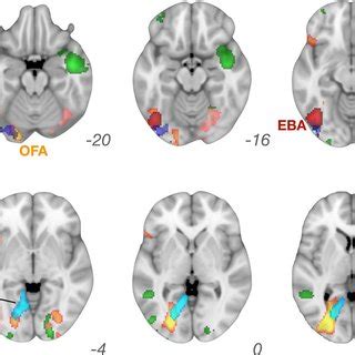 Illustration Of Source Localization Results For The Six Categories Of Download Scientific