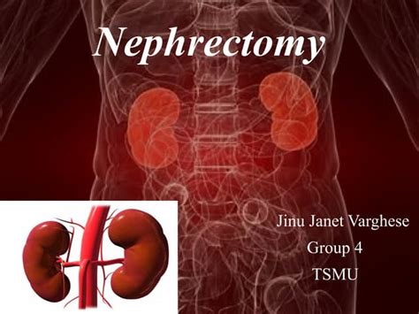 Nephrectomy Ppt
