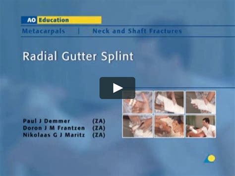 Radial Gutter Splint Pattern