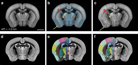 增强且统一的常见小鼠大脑图谱的解剖学标记。 Nature Communications X Mol