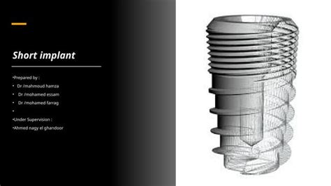 Overdentureclassificationpresentationpptx