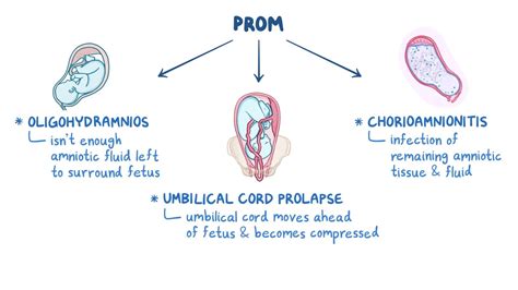 Intrapartum Complications Osmosis Video Library