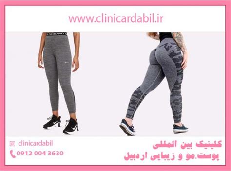 کمر باریک و باسن بزرگ با کمک روش تزریق چربی