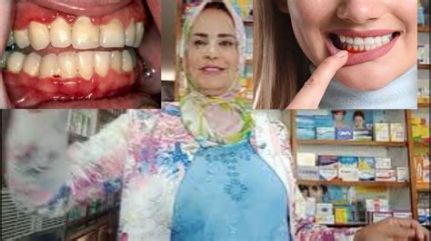دواء من صيدلية غادي يهنيك من التهابات و تراچع اللثة و الفطريات الفم و