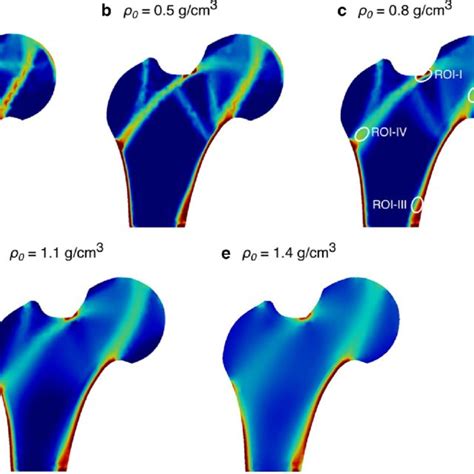 Strain Adaptive Bone Remodelling A Without And B With The Piezoelectric