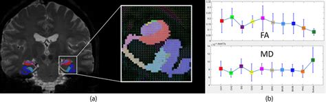 A Hippocampal Subfields Using The Ashs Method Then Transformed To The