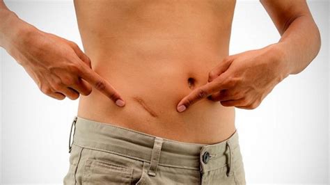 What Dream About Appendicitis Means